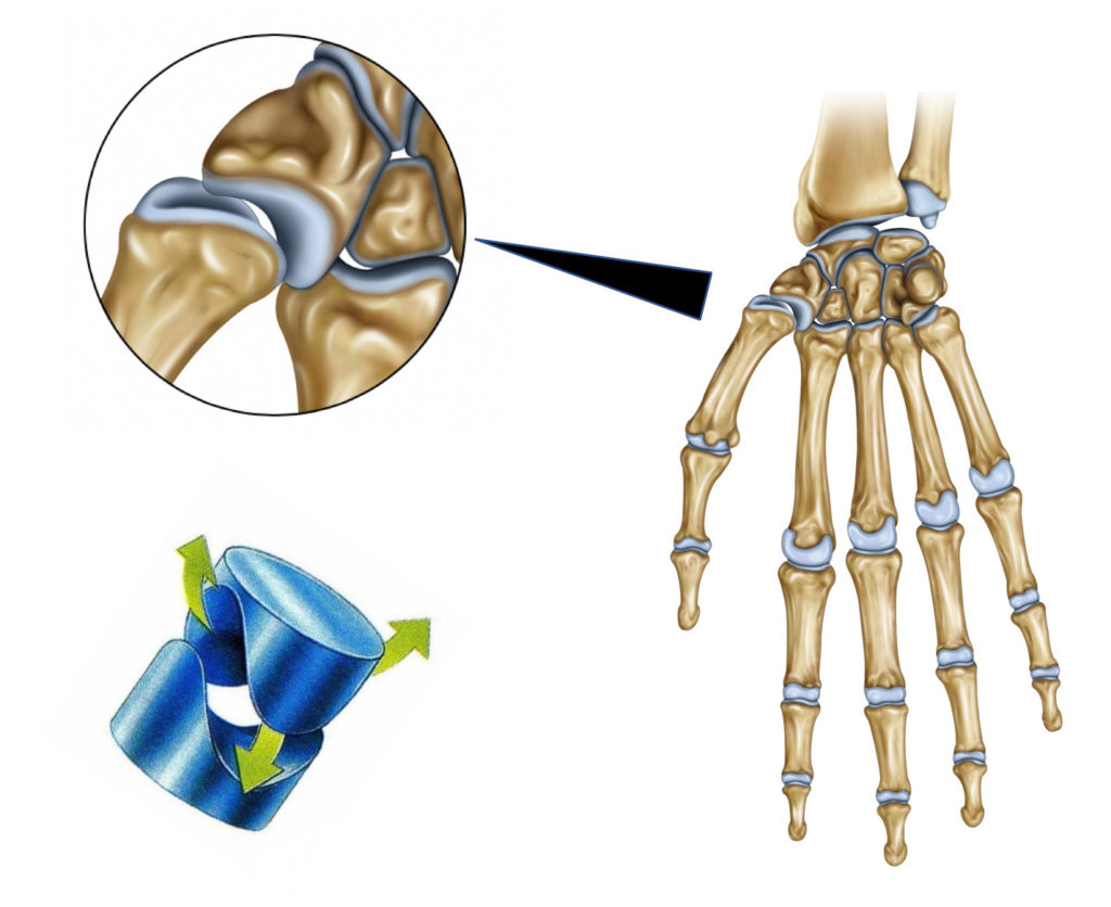 La rhizarthrose, Centre du Membre Supérieur Trénel, Vienne, isère.