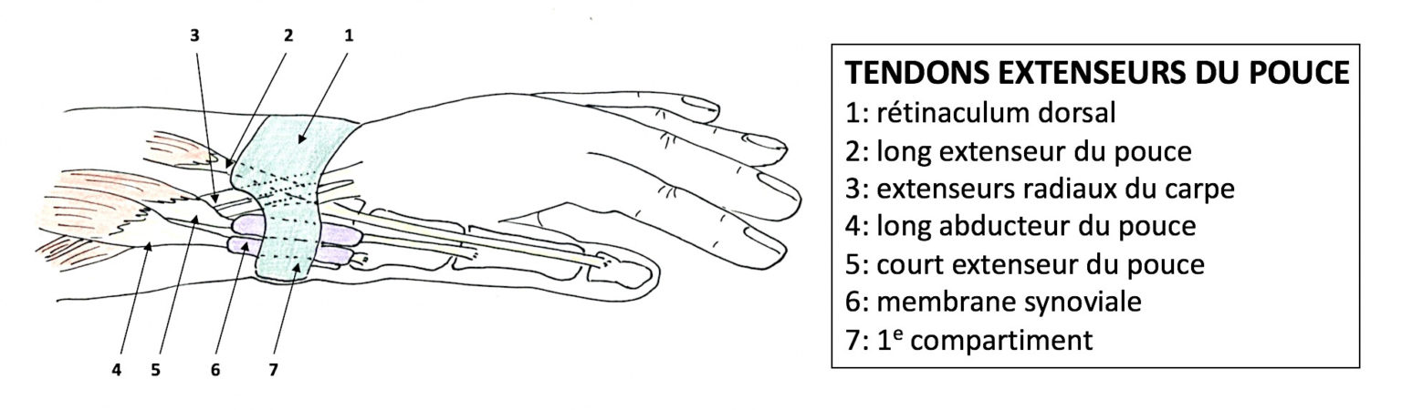 Les tendinites du poignet, Centre de Chirugie du Membre Supérieur Trénel